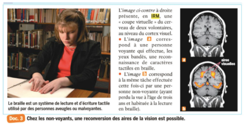 Analyse de la déficience sensorielle sur le cerveau